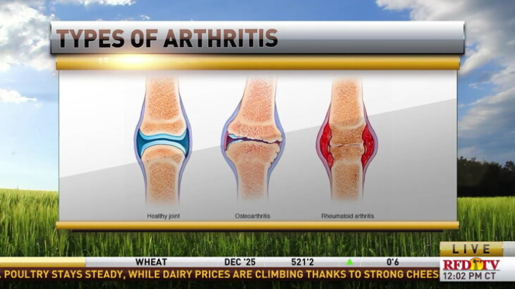 Rural Health Matters: Managing Joint Pain Caused by Farm Work - RFD